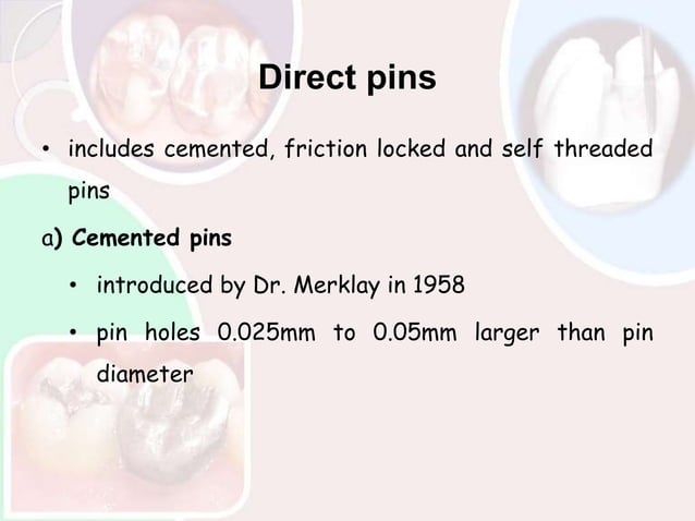Complex amalgam restoration | PPTX | Dental Health | Diseases and ...
