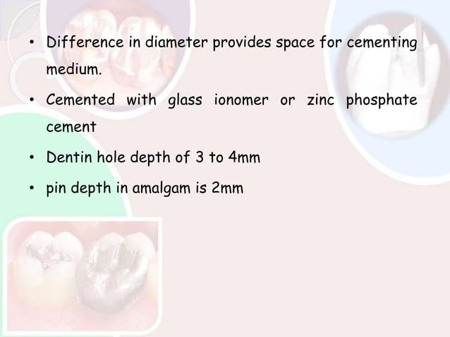Complex amalgam restoration | PPTX | Dental Health | Diseases and ...