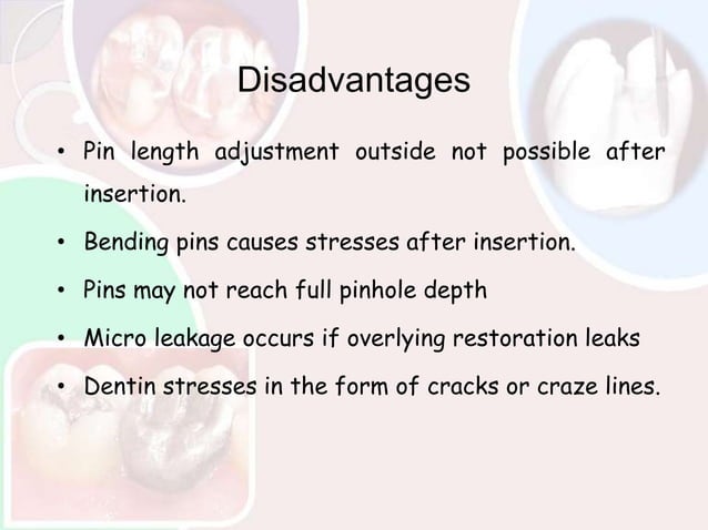 Complex amalgam restoration | PPTX | Dental Health | Diseases and ...