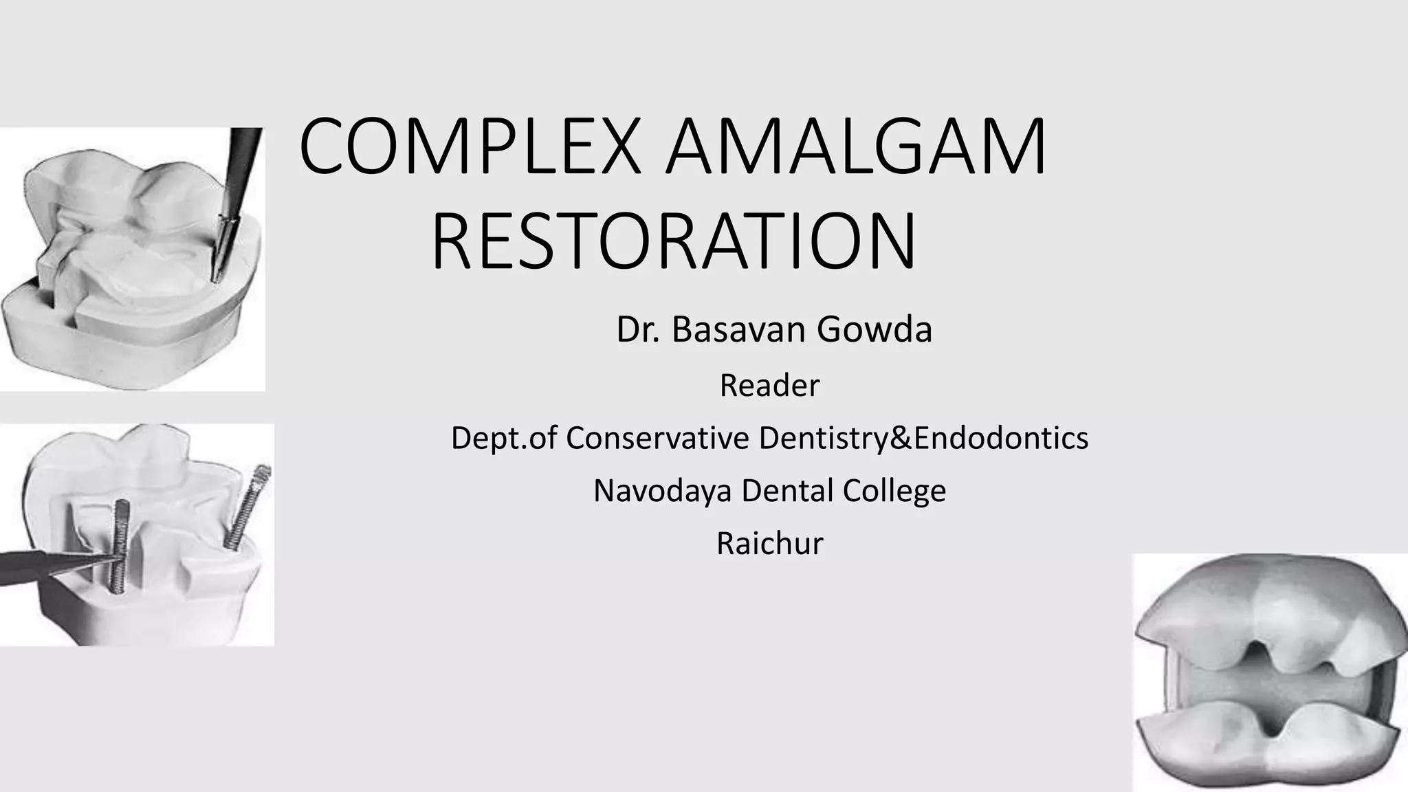 complex amalgam restoration.pptx