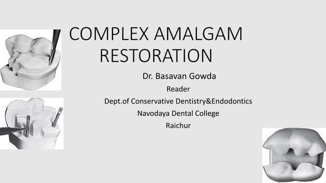 complex amalgam restoration.pptx