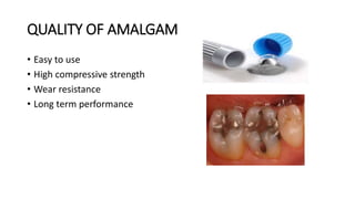 complex amalgam restoration.pptx