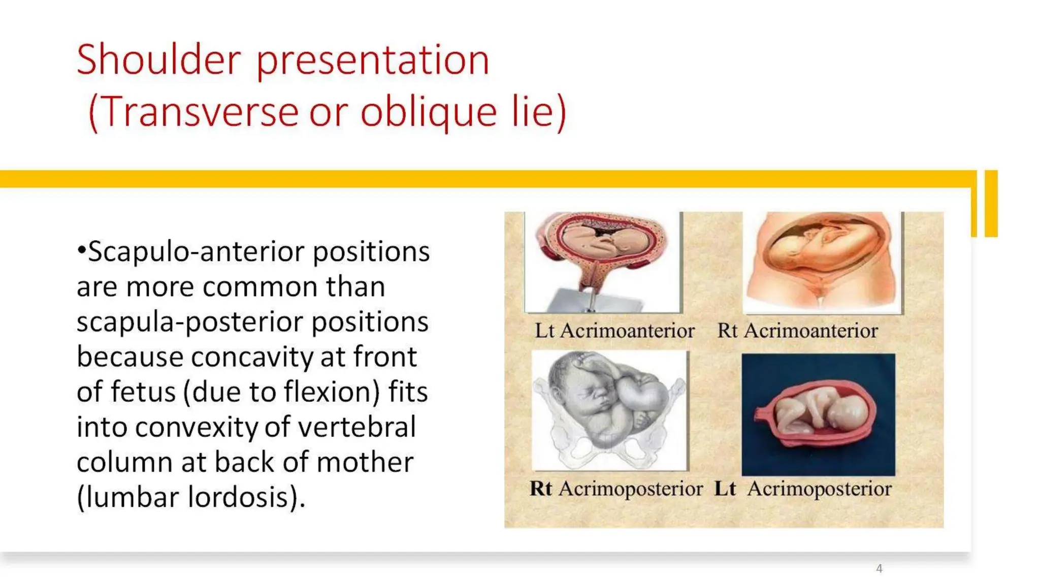 complex and shoulder presentation&cord prolapse and presentation.pptx