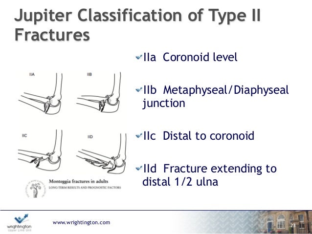 Complex elbow injuries involving radial head