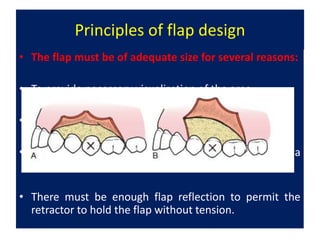 Complex exodontia contemporary chapter 8.pptx