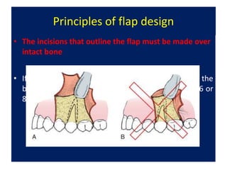 Complex exodontia contemporary chapter 8.pptx