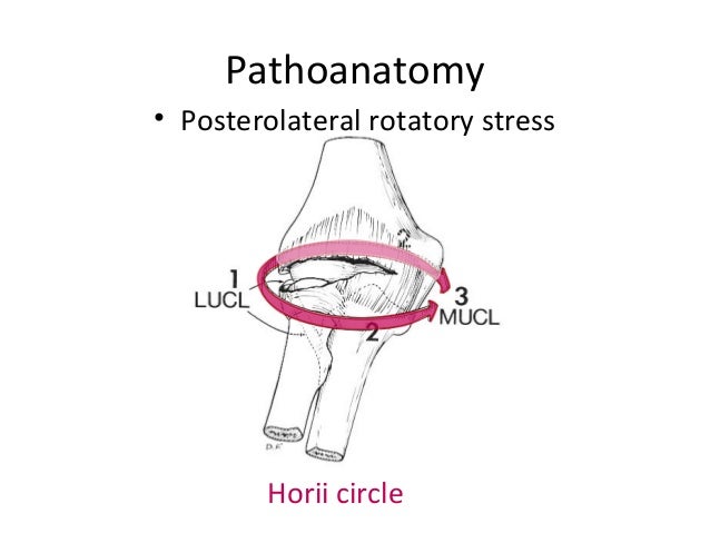 Complex fractures elbow eexot 2014
