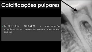 COMPLEXO DENTINO-PULPAR E SUAS FUNCIONALIDADES NA ODONTOLOGIA | PDF