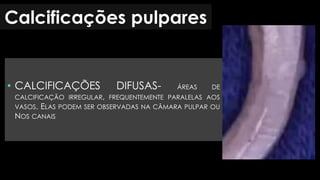 COMPLEXO DENTINO-PULPAR E SUAS FUNCIONALIDADES NA ODONTOLOGIA | PDF