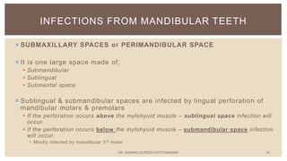 Complex Odontogenic Infection (Oral & Maxillofacial Surgery - Dentistry ...