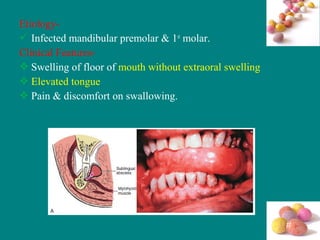 Complex odontogenic infections | PPT