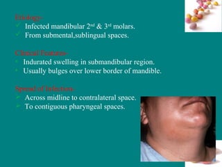 Complex odontogenic infections | PPT
