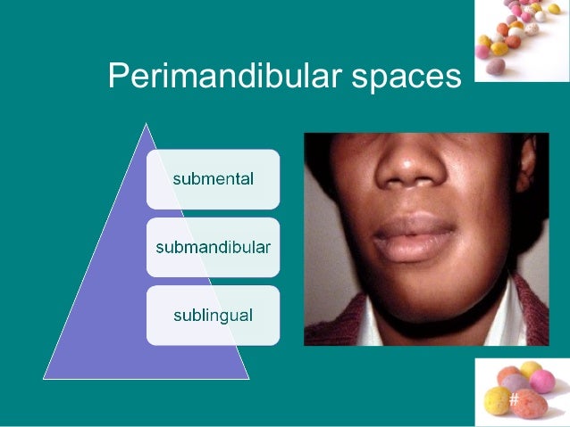 Complex odontogenic infections