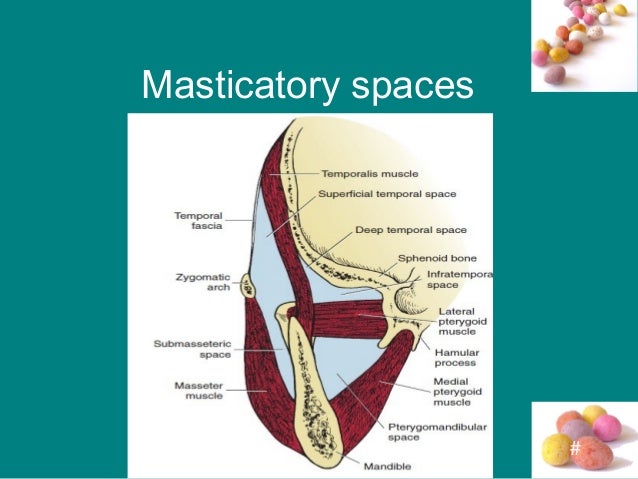 Complex odontogenic infections