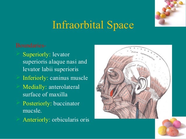 Complex odontogenic infections