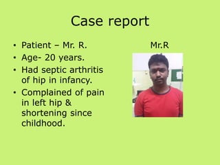 Complex primary hip replacement Dr.A.K.Venkatachalam | PPTX
