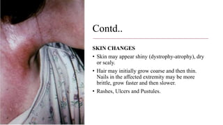 Complex regional | PPT