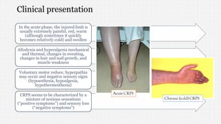 Complex regional pain syndrome.pptx