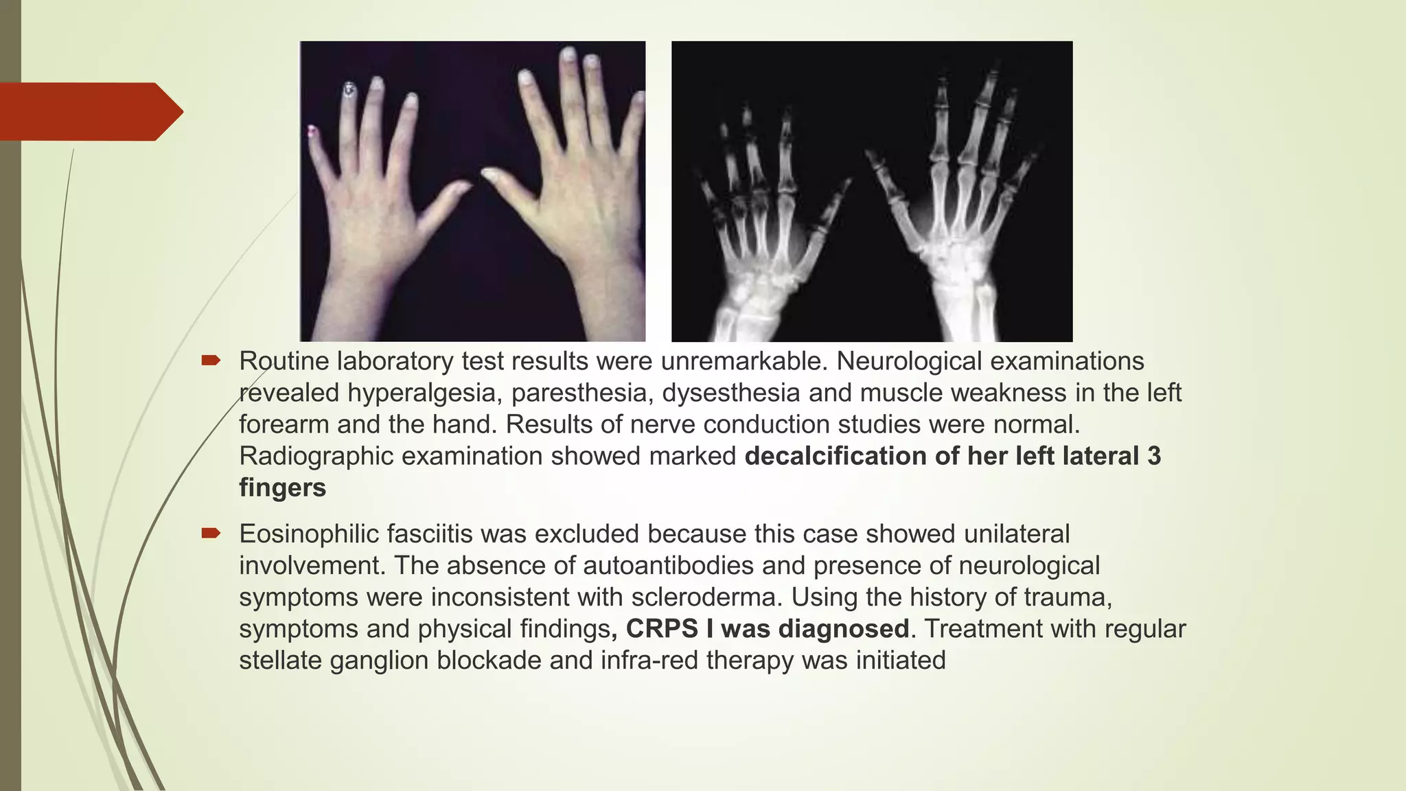 COMPLEX REGIONAL PAIN SYNDROME.pptx