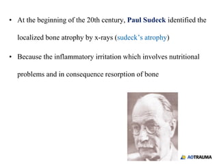 Complex regional pain syndrome | PDF | Brain and Nervous System ...