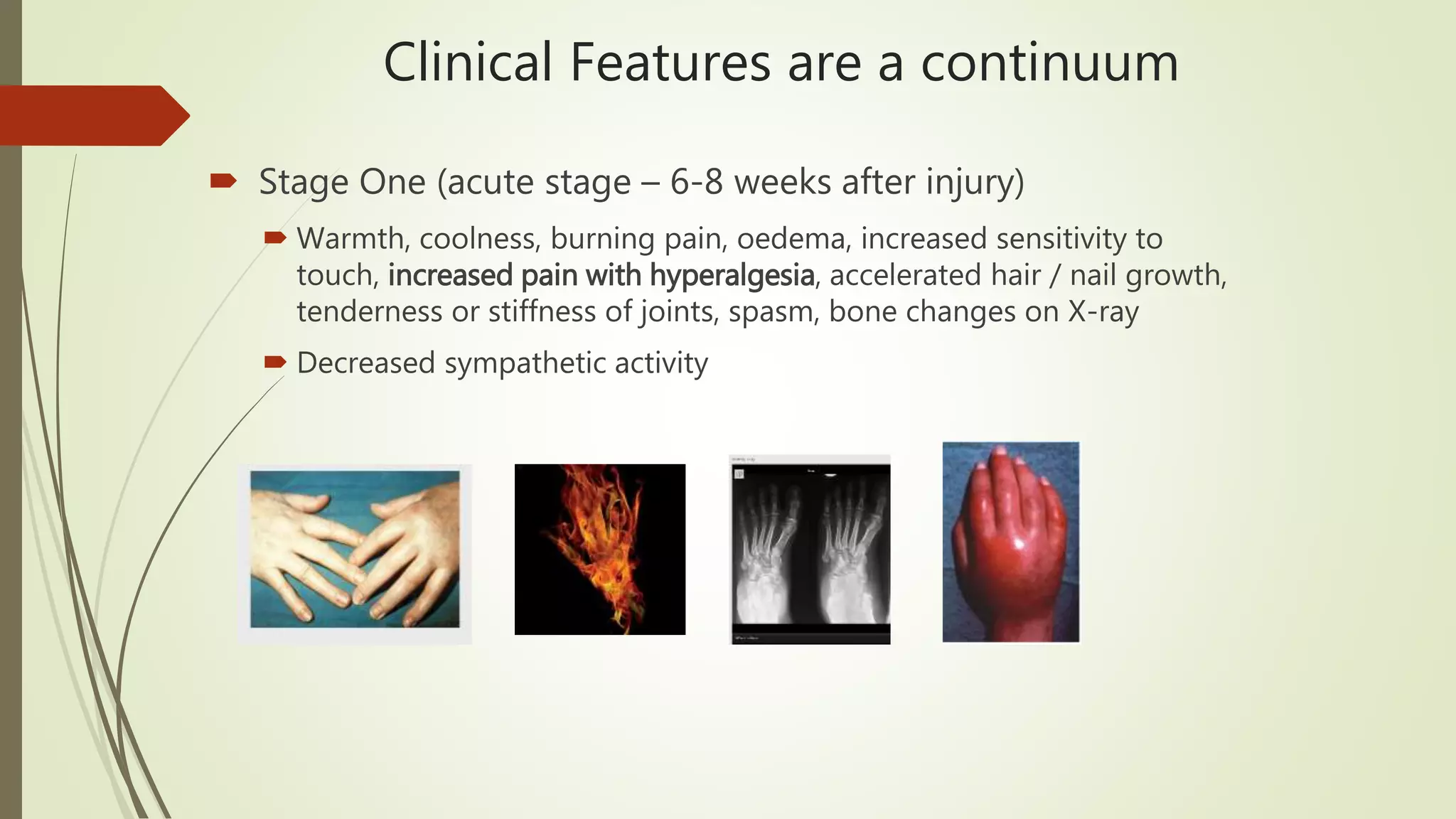 Complex regional pain syndrome | PPTX