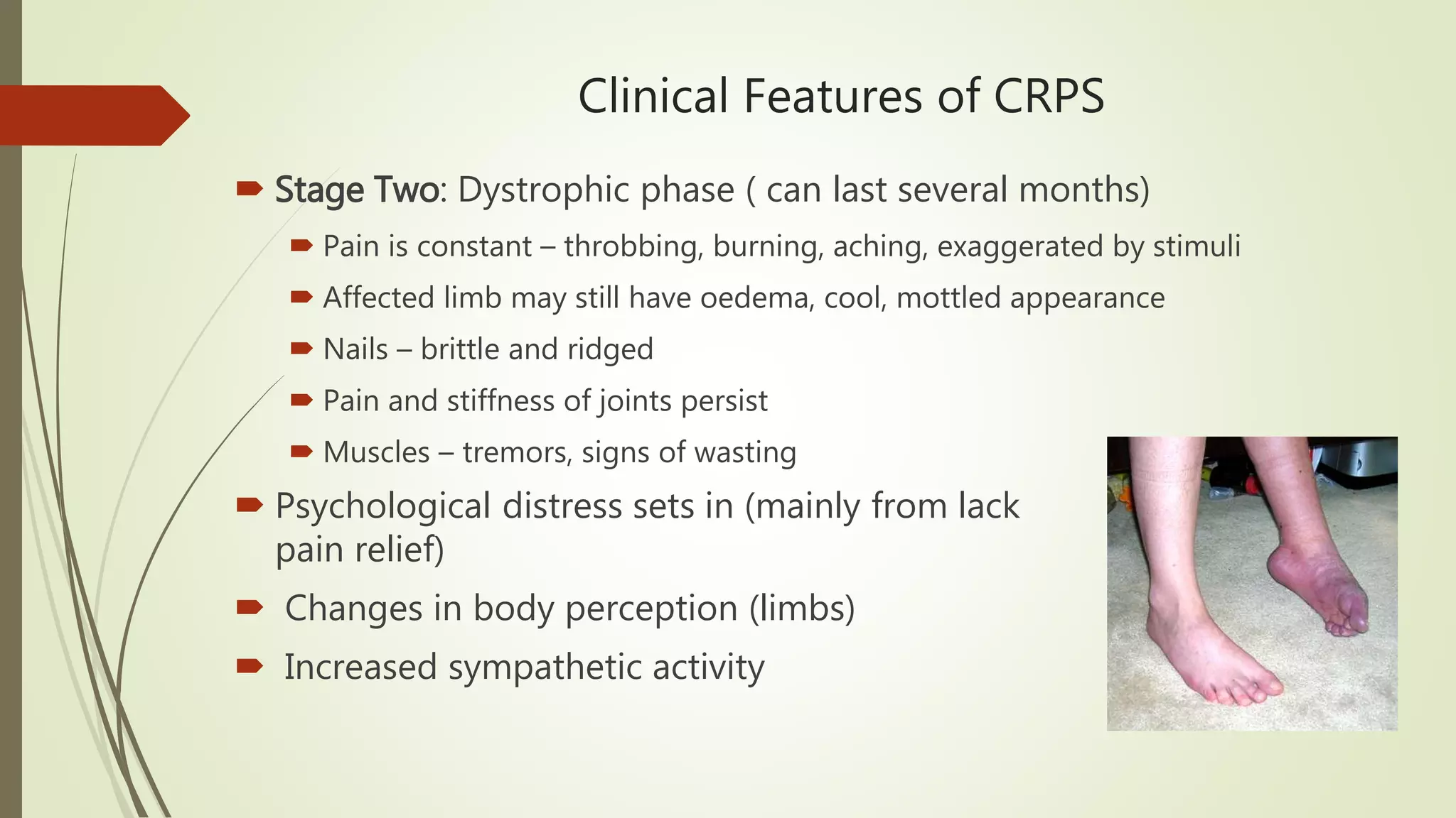 Complex regional pain syndrome | PPTX