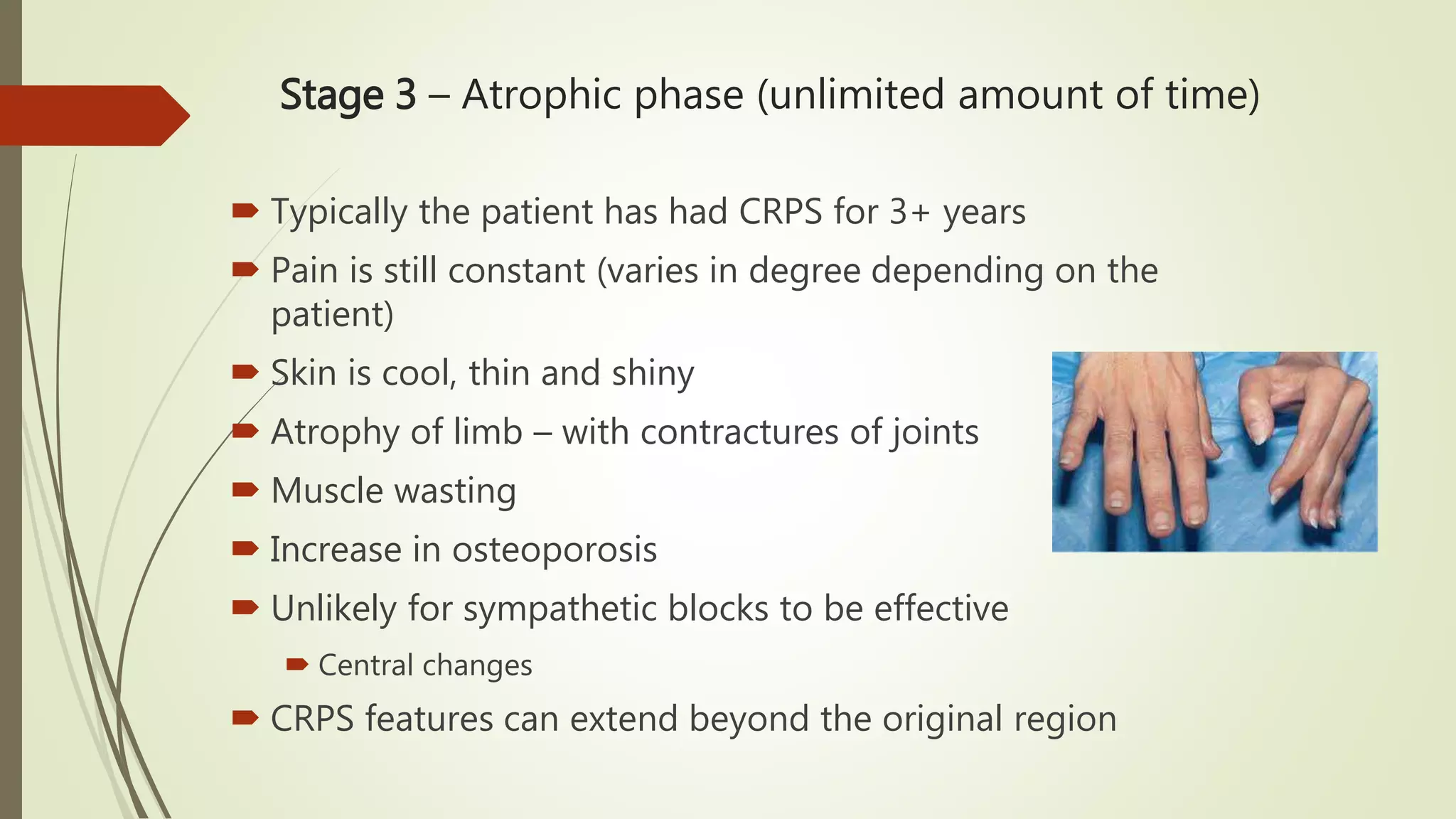 Complex regional pain syndrome | PPTX