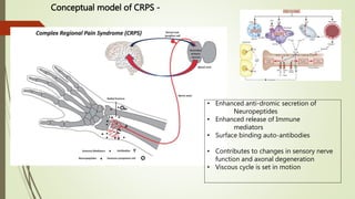 Complex regional pain syndrome | PPTX