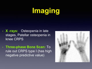 Complex Regional Pain Syndrome | PPTX