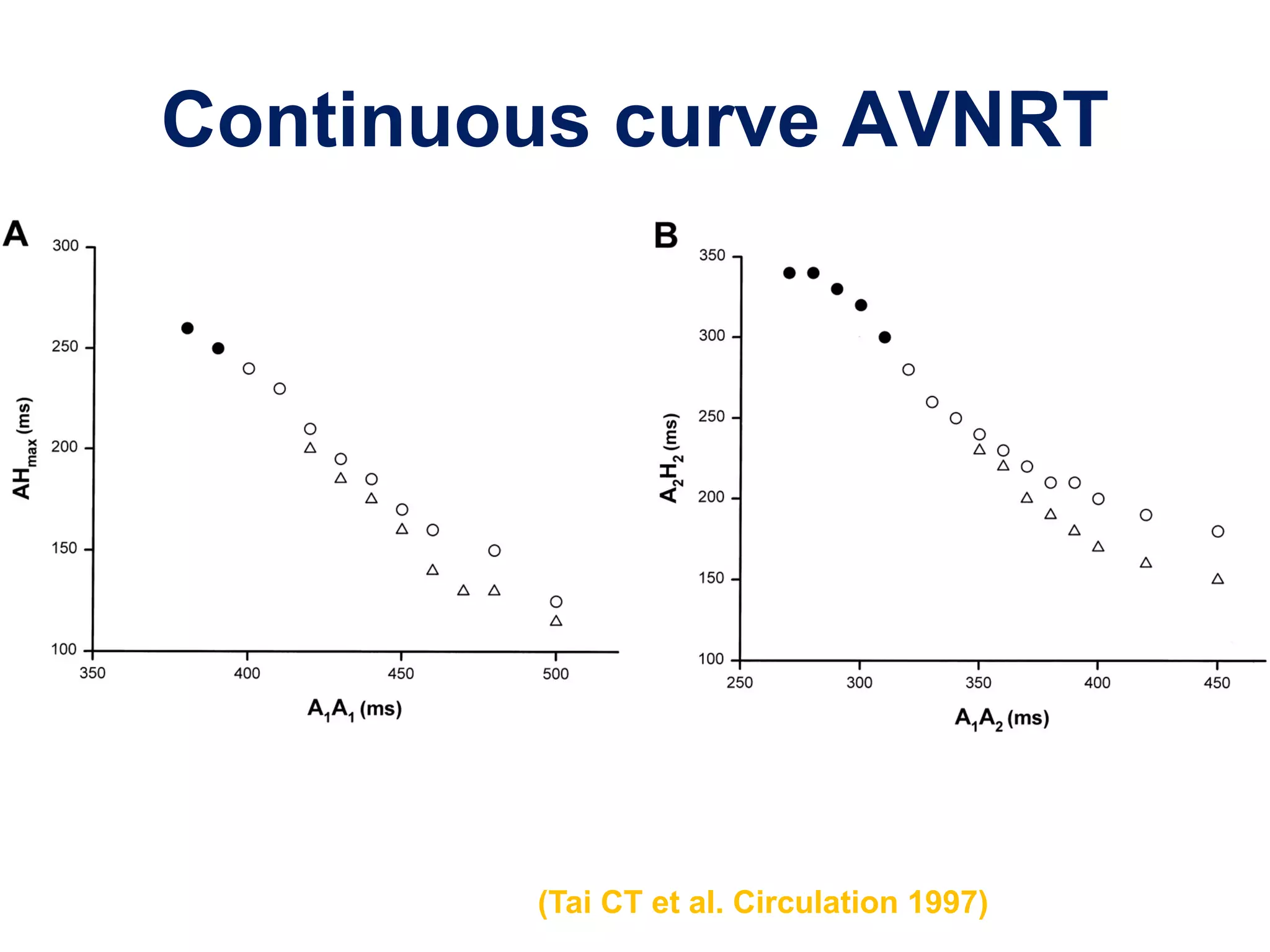 Differentiation between AVNRT and AVRT_advanced lecture | PDF