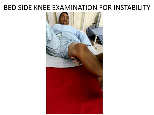 Complex TOTAL KNEE ARTHROPLASTY | PPT