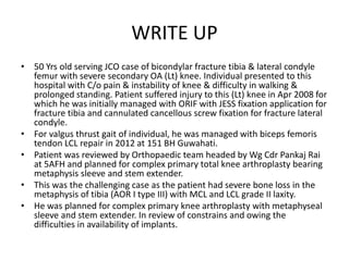 Complex TOTAL KNEE ARTHROPLASTY | PPT