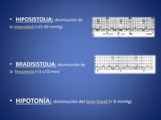 Complicaciones del parto 1 | PPTX