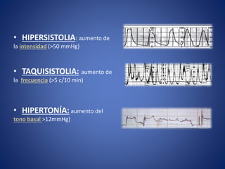 Complicaciones del parto 1 | PPTX