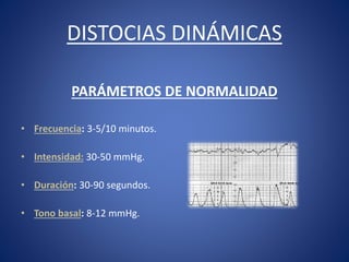 Complicaciones del parto 1 | PPTX