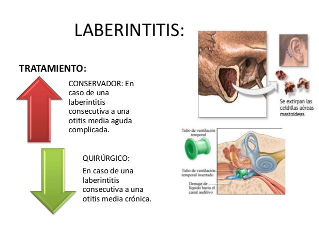 Complicaciones otitis