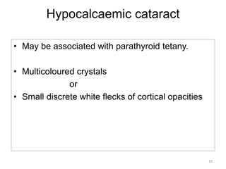 complicated_cataract. Presentation slide | PPTX