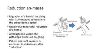 Complicated hernia | PPTX