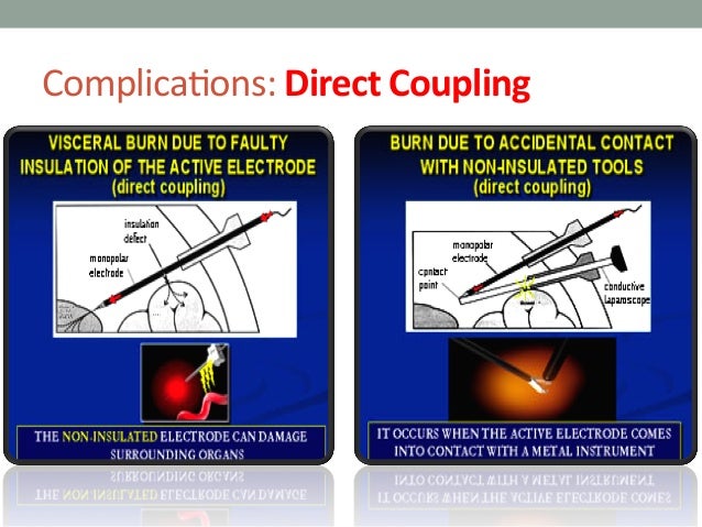 Complication of laparoscopy