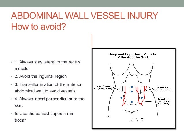 Complication of laparoscopy