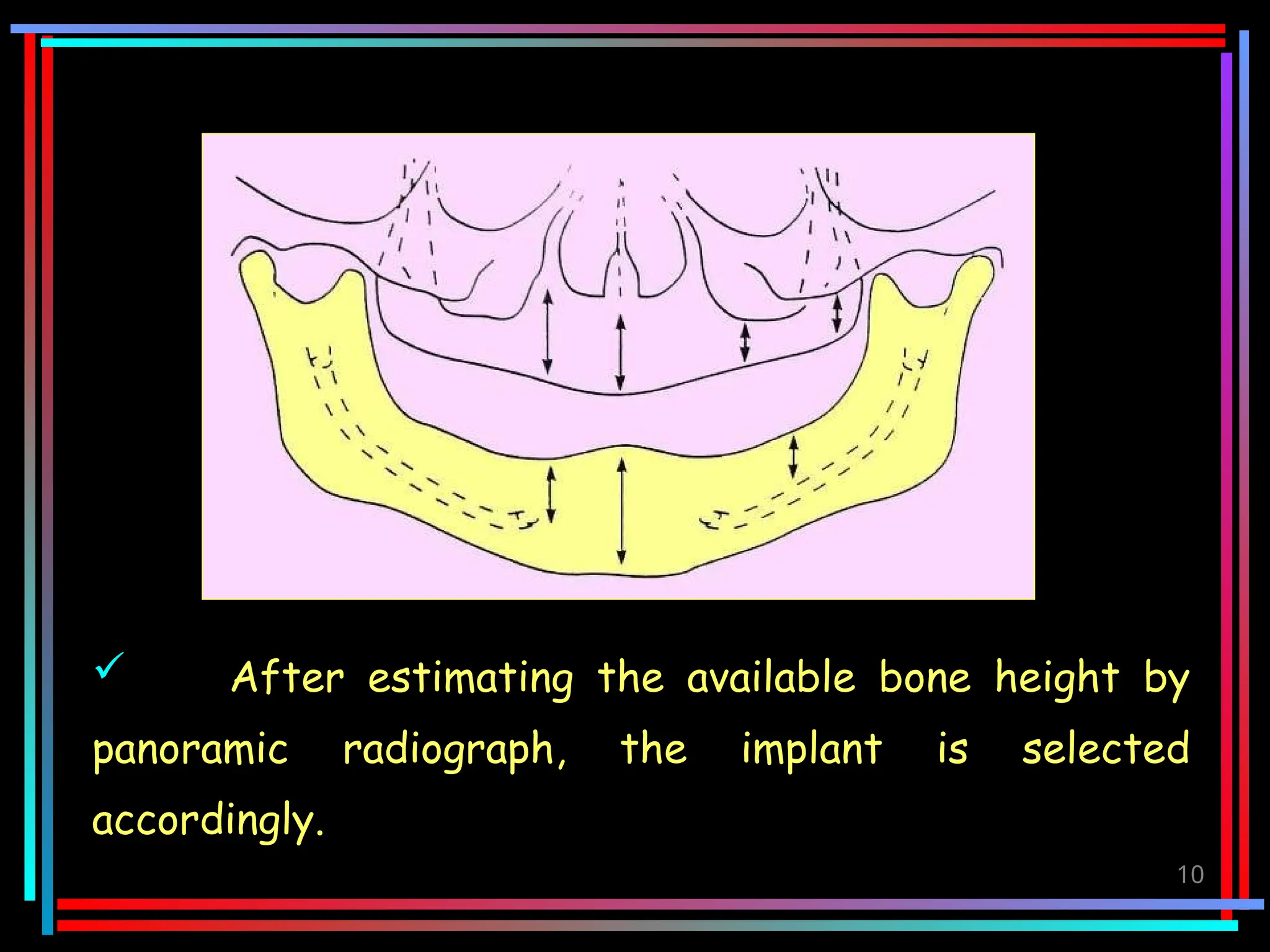 Complication & Failure of Implants in prosthodontics | PPT