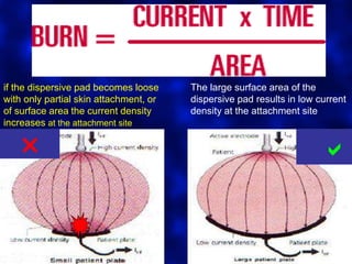 Complication laparoscopic electrosurgery | PPT