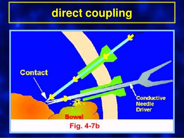 Complication laparoscopic electrosurgery