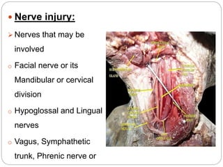 Complication neck dissection | PPTX