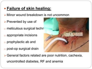 Radical Neck Dissection Post Op