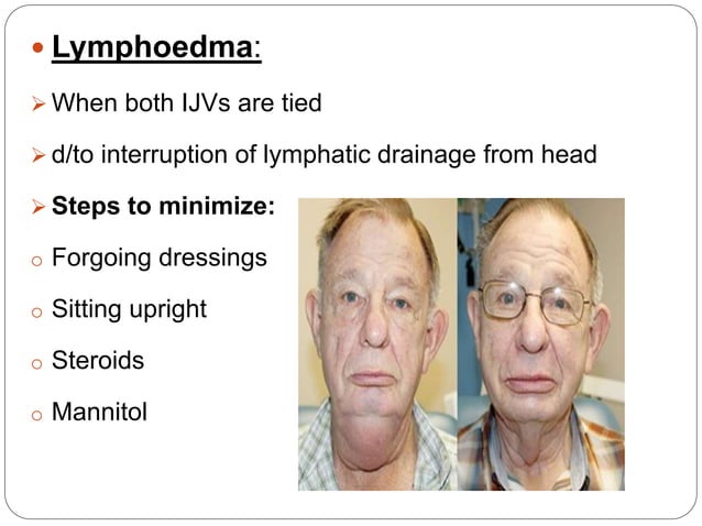 Complication neck dissection | PPT