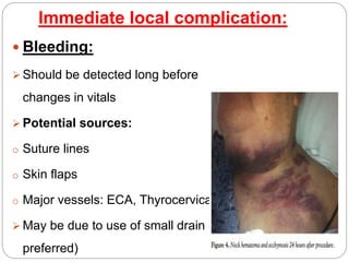 Complication neck dissection | PPTX