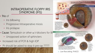 Complication of catarct surgery | PPTX