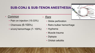 Complication of catarct surgery | PPTX
