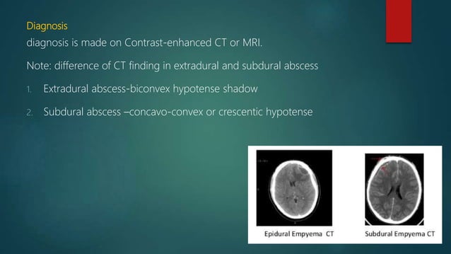 Complication of CSOM | PPTX | Ear, Nose and Throat Conditions ...